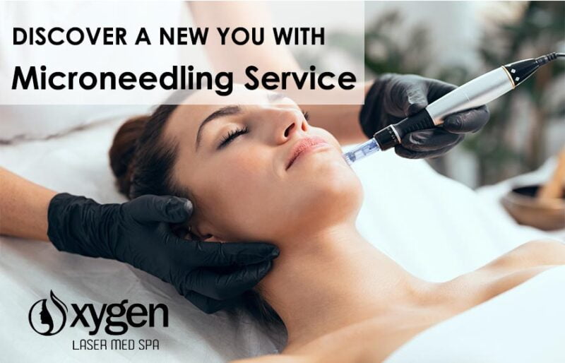 Microneedling - Oxygen Med Spa Orland Park | Laser, Facials, & More