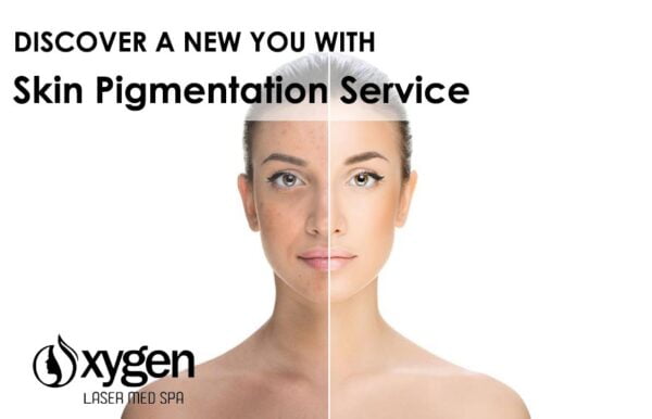Skin Pigmentation - Oxygen Med Spa Orland Park | Laser, Facials, & More