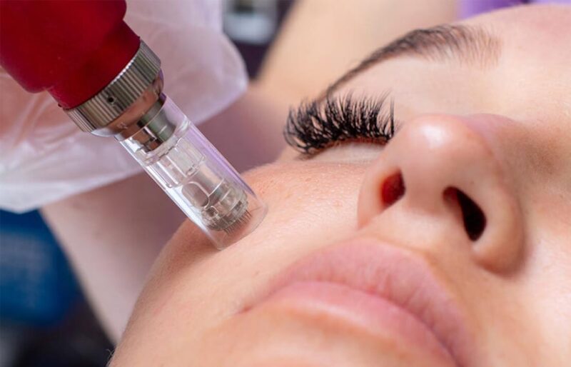 Services Oxygen Med Spa | Orland Park IL Medical Spa